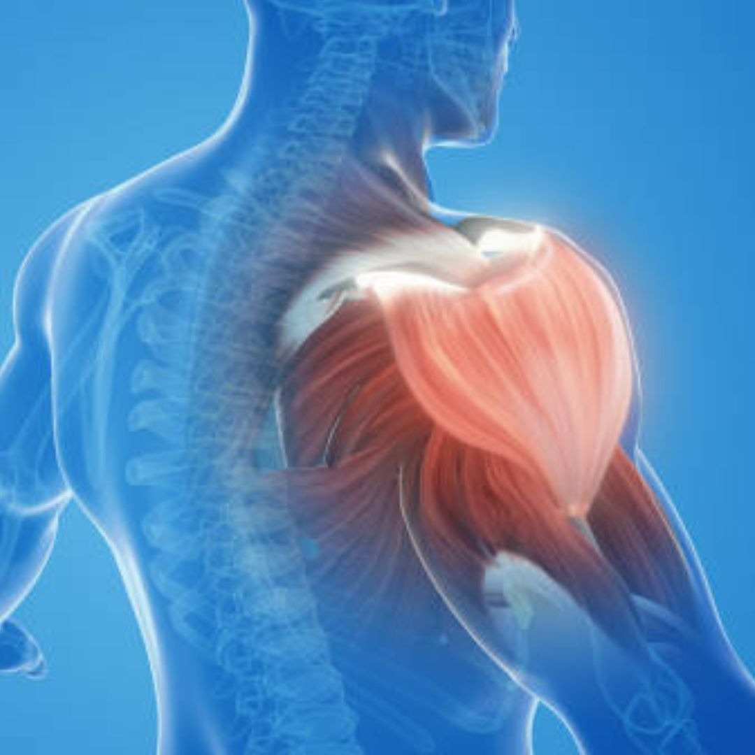 Laser therapy for muscle pain in Brighton MA